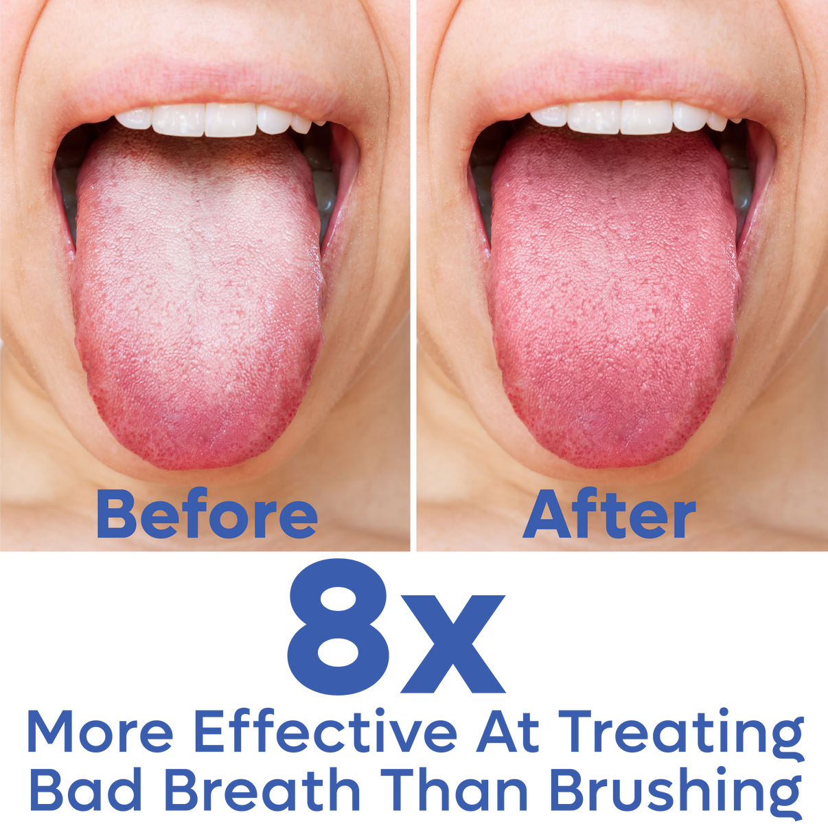 Tongue Scraper - Dual – SmartLifeco